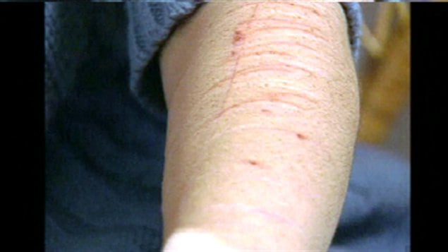 Augmentation des cas d'automutilation dans la prison pour femmes de la ...