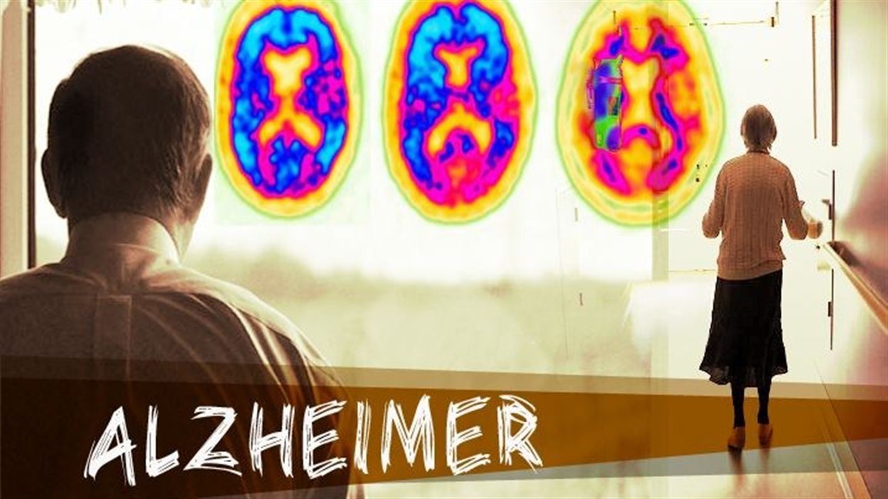 L'alzheimer diagnostiqué plus rapidement | ICI.Radio-Canada.ca